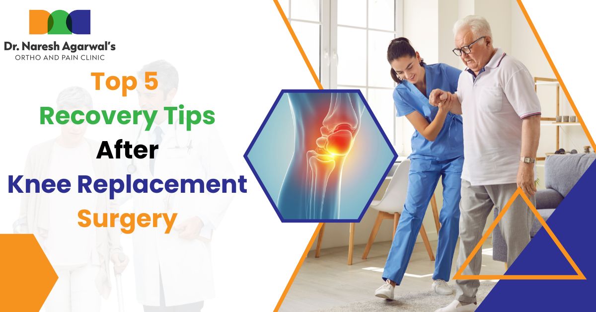 Top 5 Recovery Tips After Knee Replacement Surgery ...